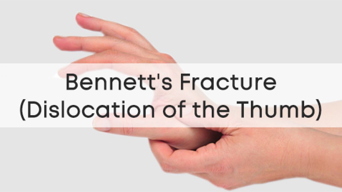 Bennett Fracture Treatment
