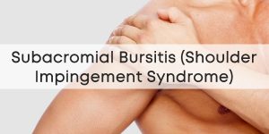 Shoulder Bursitis | PhysioRoom Injury Advice