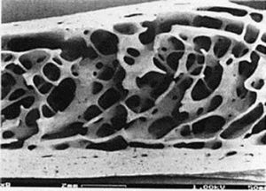 How Your Broken Bones Heal | PhysioRoom Injury Advice