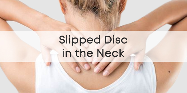 Common Neck Injuries | PhysioRoom Injury Advice