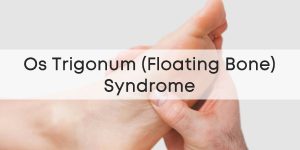 Os Trigonum Syndrome | PhysioRoom Injury Advice